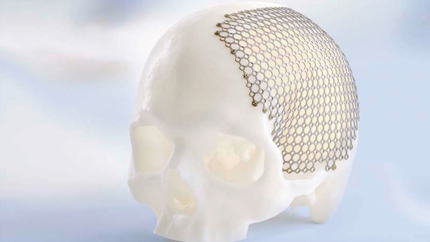 CMF SYSTEM – Expert Medical Holding